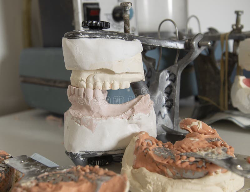 Shot of Dental Impression Molds for Reconstruction Stock Photo - Image ...