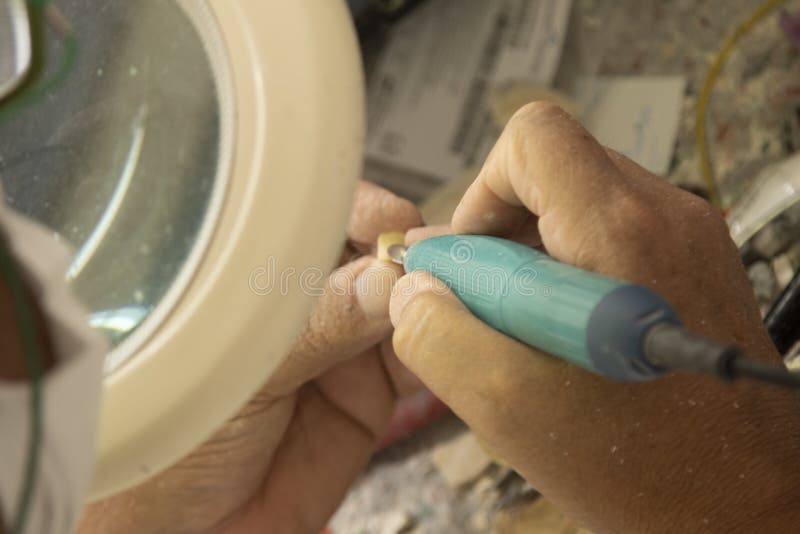 Shot of Dental Impression Molds for Reconstruction Stock Image - Image ...