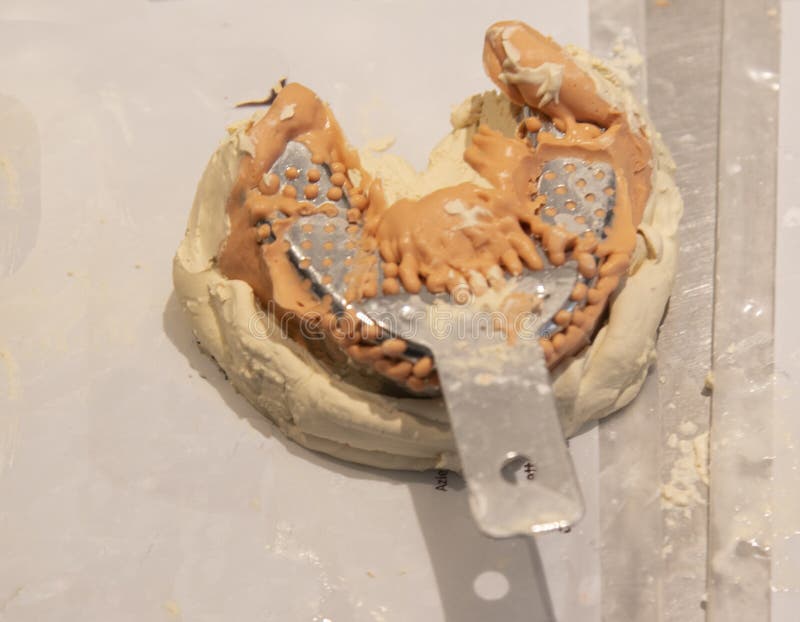 Shot of Dental Impression Molds for Reconstruction Stock Photo - Image ...