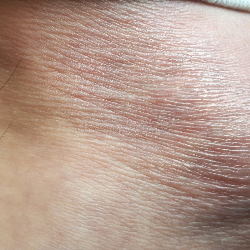 Shot of human skin leg stock photo. Image of body, human - 144774344