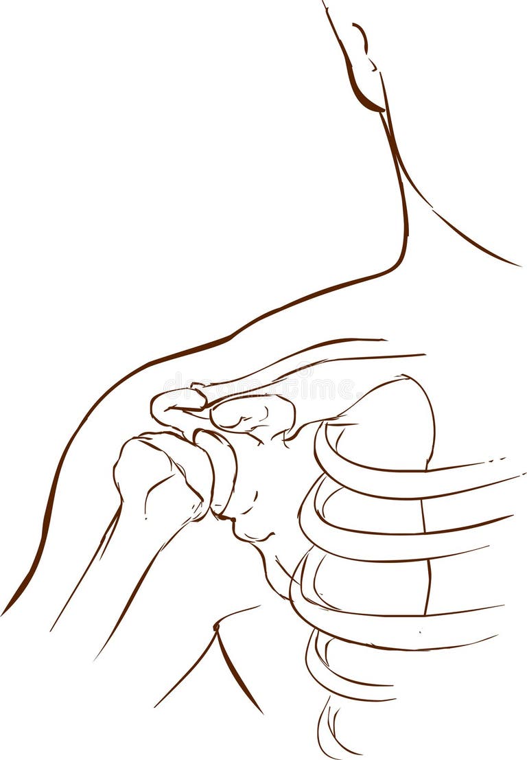 Dislocation Stock Illustrations – 1,241 Dislocation Stock Illustrations ...