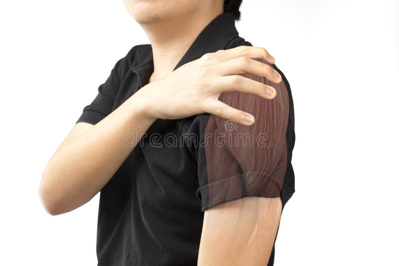 Shoulder muscle injury stock image. Image of inflammation - 137182131