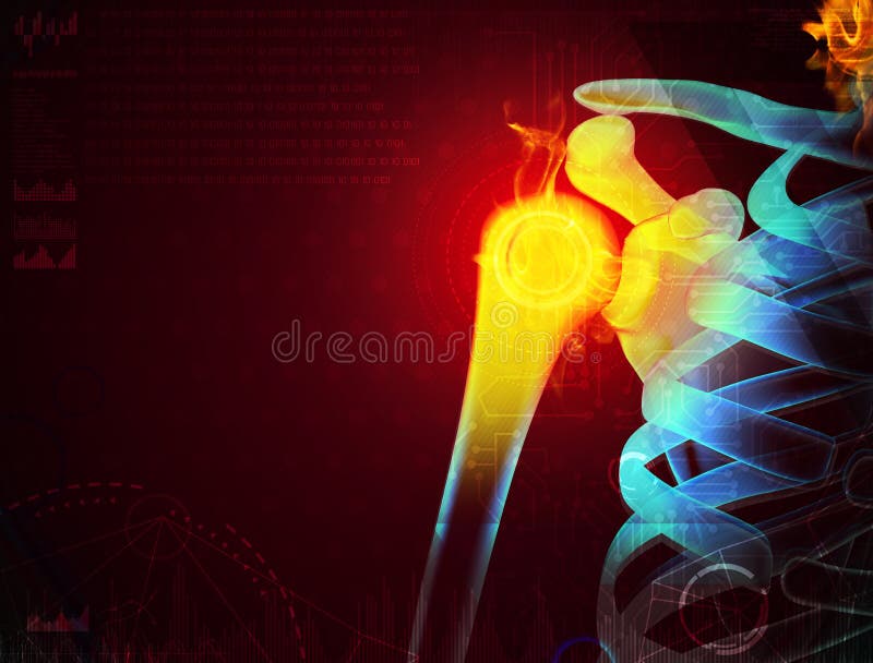 Shoulder Pain Pointer in Female Anatomy Silhouette Stock Vector ...