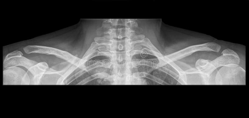 Dog body x-ray stock photo. Image of black, injury, bones - 4209988