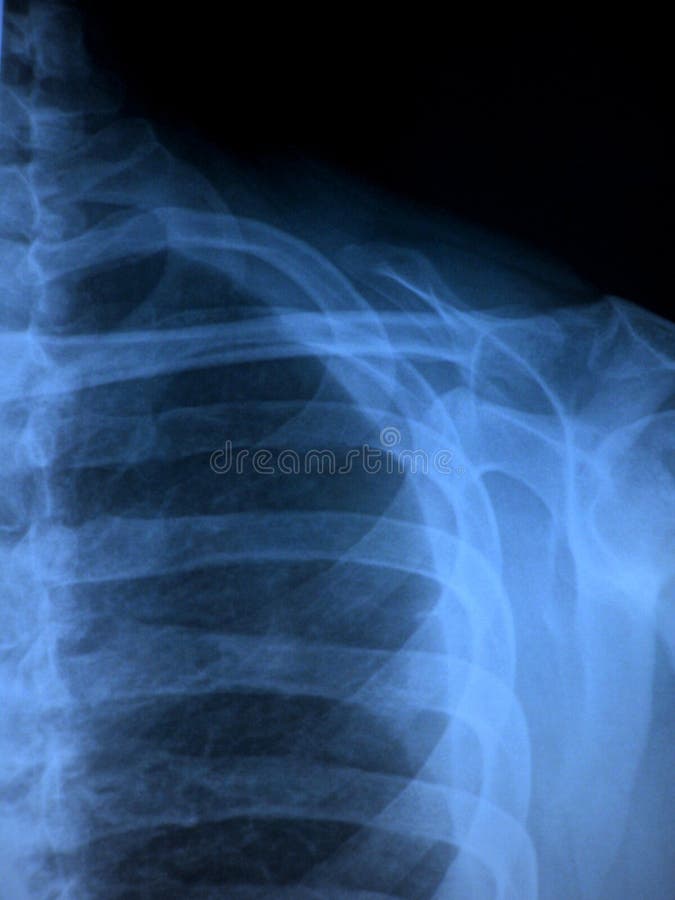 Dog x-ray stock photo. Image of medical, structure, rays - 4378154