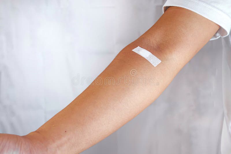 Showing Injection Marks, Concept of Blood Donor Stock Photo - Image of ...