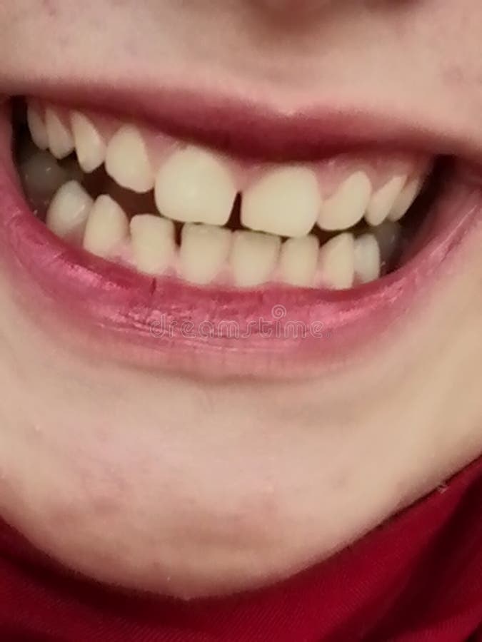 Showing teeth stock image. Image of lips, showing, teeth - 166130167