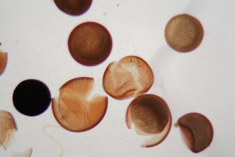 Shrimp Eggs Under the Microscope Stock Photo - Image of food ...