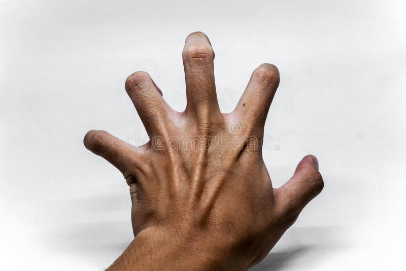 Sick Convulsing Hand Gesture Stock Image - Image of expression, hand ...
