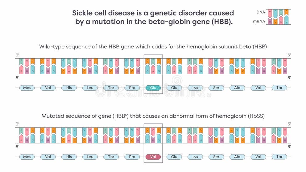 Sickle Cell SNP Mutation in the Beta-globin HBB Gene Graphic ...