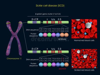 Sickle Cell Disease Mutation Stock Illustration - Illustration of ...