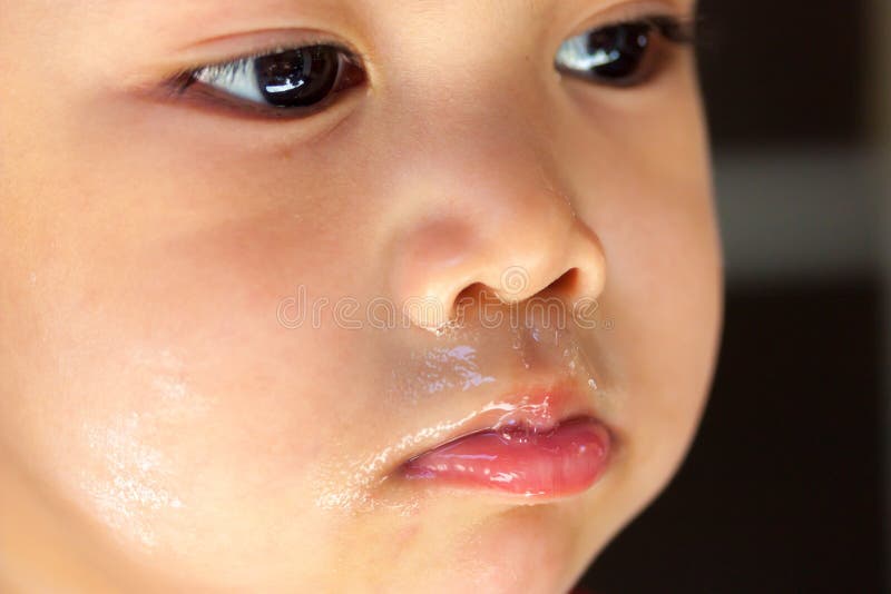 Sickness Asian Baby Boy Face Stock Photo - Image of cold, snot: 194254204