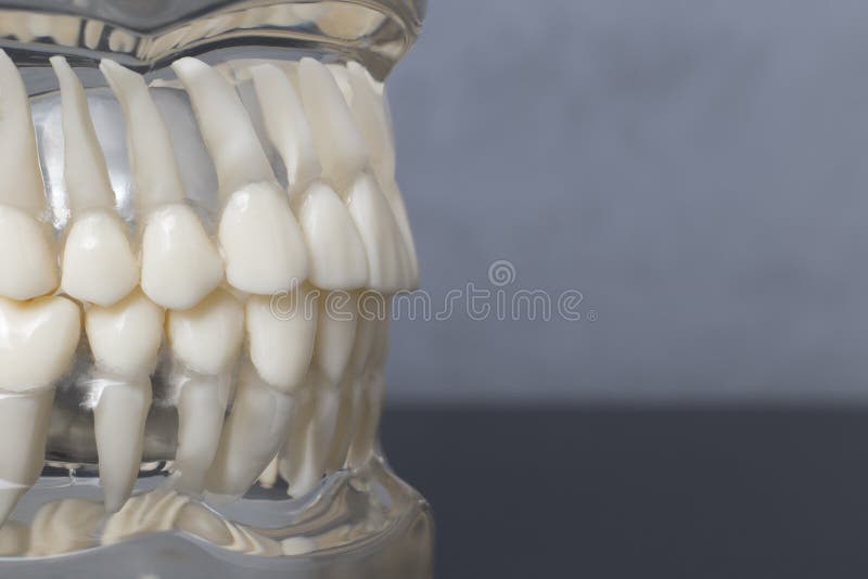 Close Up of Dentures with Gold Teeth Stock Photo - Image of space, gold ...
