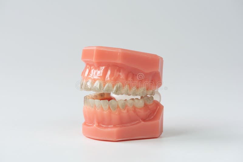 Side View of Dental Model stock photo. Image of dental - 331910464