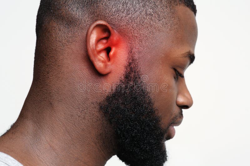 Black Guy with Inflamed Ear, Side View Stock Photo - Image of illness ...