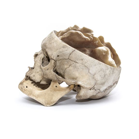 Side View of Human Skull with Walnut instead of Brain Stock Photo ...