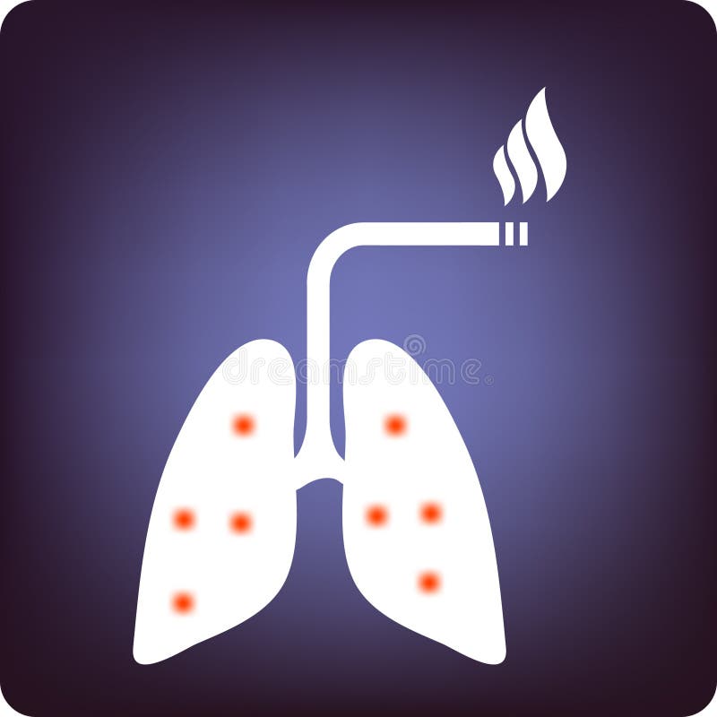 Sigaret en longen vector illustratie. Illustration of geneeskunde - 4019498