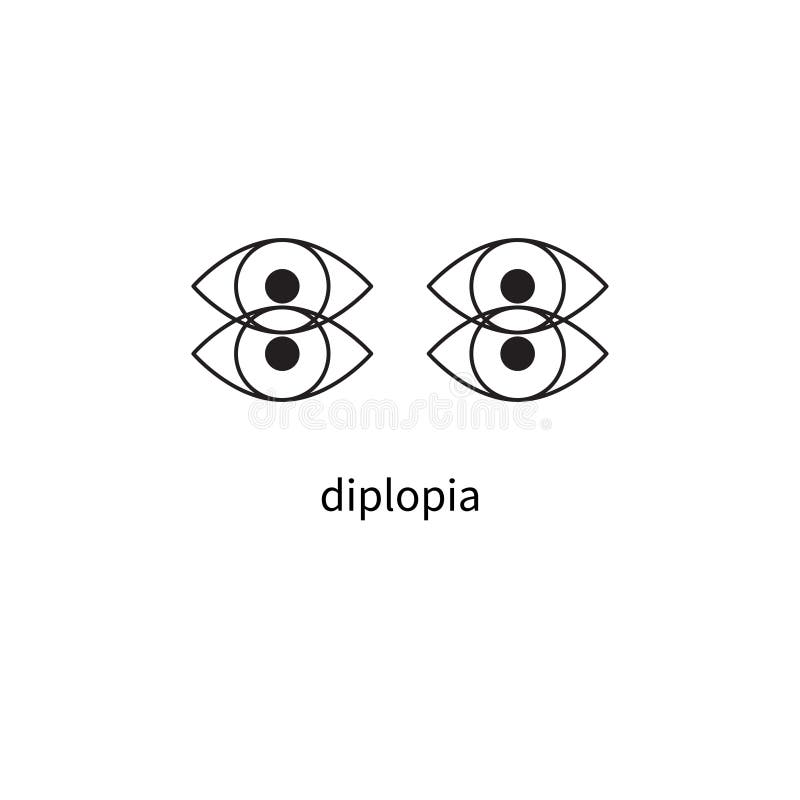 Signe De Diplopie, Double Vision Illustration de Vecteur - Illustration ...