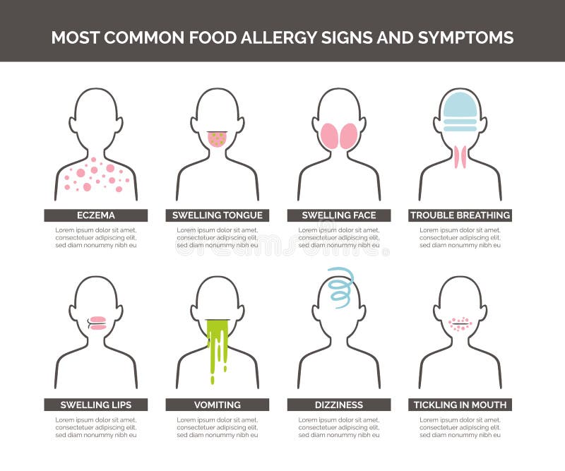 Signes Et Symptômes D'allergie Alimentaire Illustration de Vecteur ...