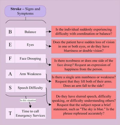 Signs and Symptoms of Stroke - BE-FAST Acronym Stock Illustration ...