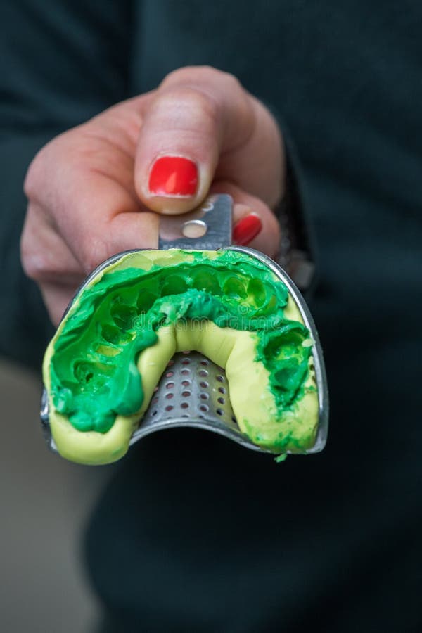 Silicone mold dental stock image. Image of plastic, holding - 59819401