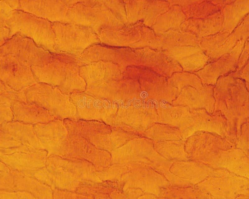 Skin. layer. Silver stain stock photo. Image of skin - 231124894