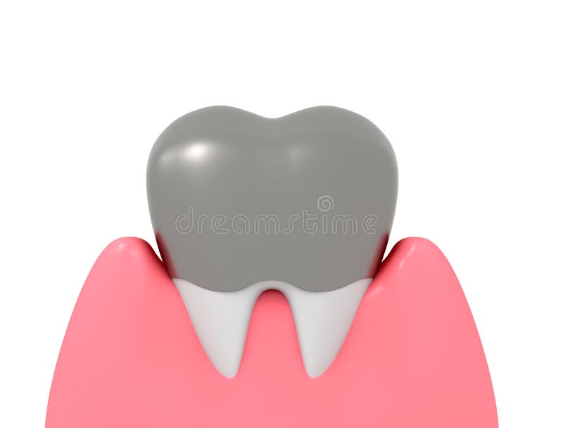 Silver tooth stock illustration. Illustration of medical - 166184146
