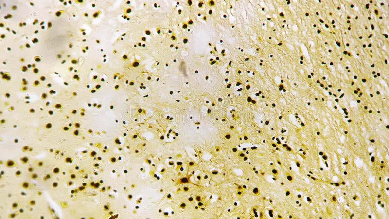 Silvering Cerebrum in Section of Human Being Filmed Under Microscope ...
