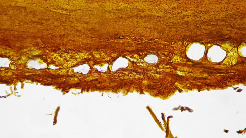 Longitudinal Section of Human Tongue Showing Filiform Papillae Under ...