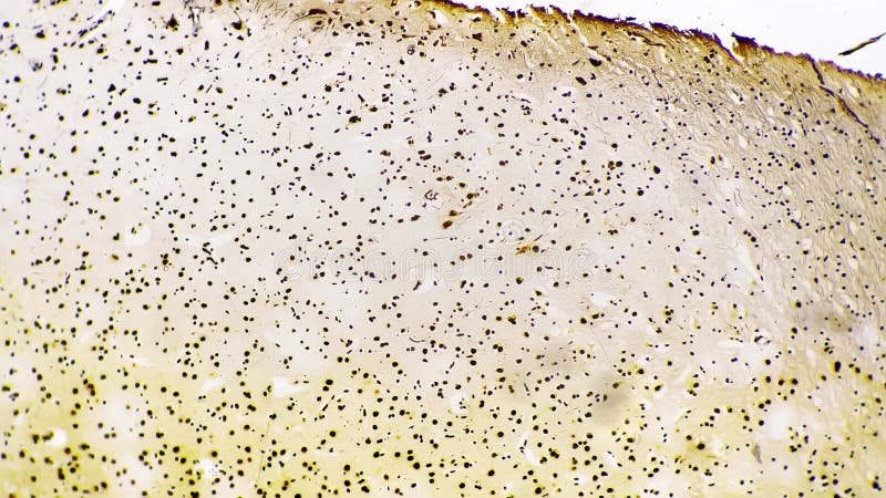 Silvering Pattern of Human Cerebrum Shown Under Microscope with 100x ...
