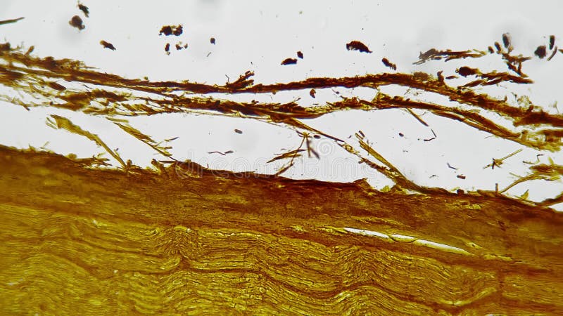 Silvering Pattern of Human Nerves Trunk in Longitudinal Section Filmed ...
