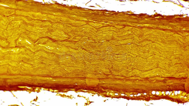 Silvering Pattern of Human Nerves Trunk in Longitudinal Section Under ...