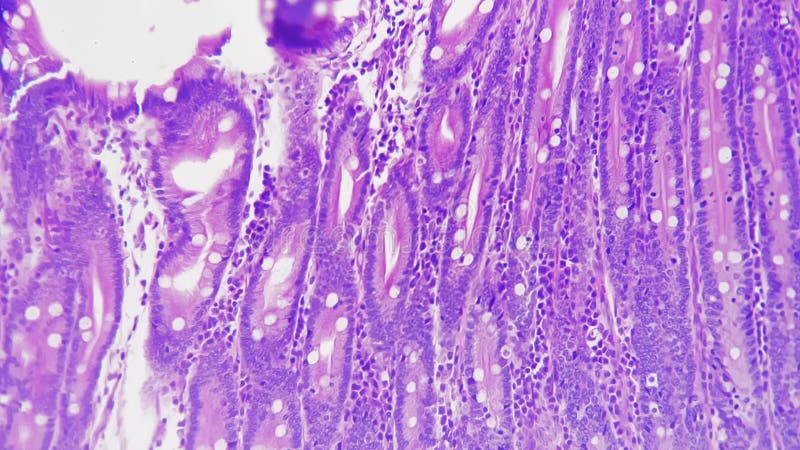 Simple Columna Epithelium of Life Being Filmed in Section Under ...