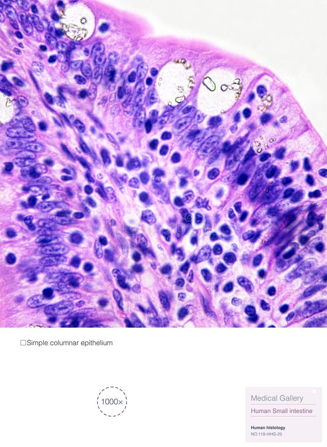 Simple columnar epithelium stock image. Image of intestinal - 368267075