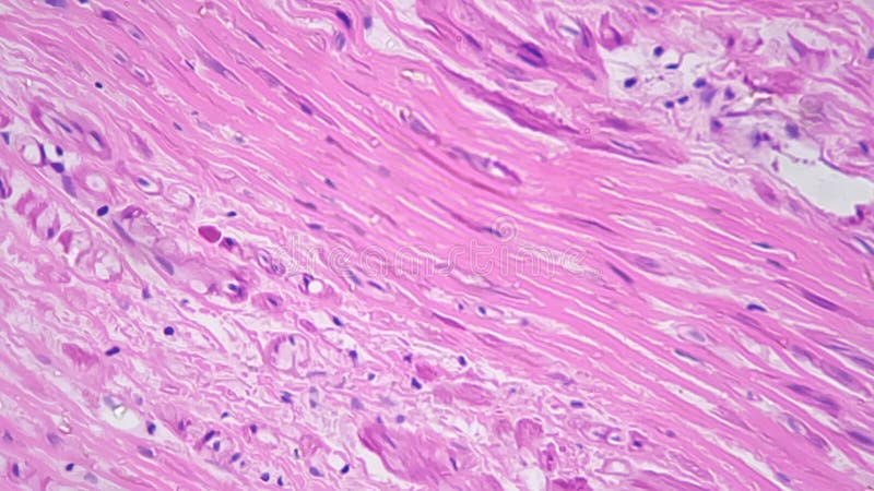 Simple Squamous Epithelium Sec Filmed Under Microscope with 100 Times ...