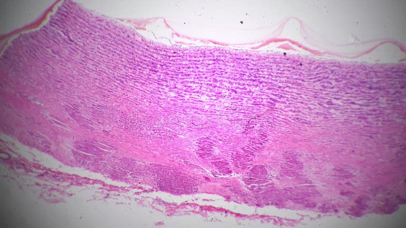 Simple Squamous Epithelium Sec Filmed Under Microscope with 100 Times ...