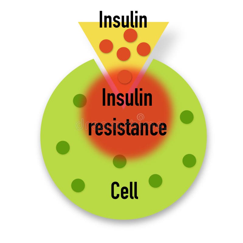 Insulin and Insulin Resistance, Educational Sheet Stock Illustration ...