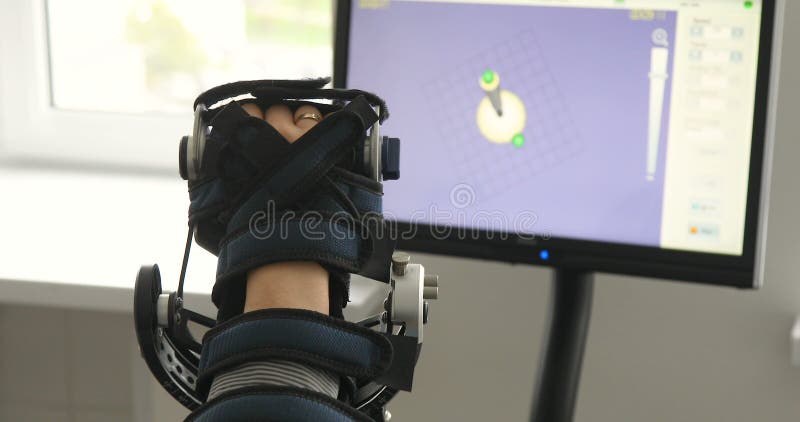 Simulator for Restoring the Mobility of the Hand Stock Video - Video of ...