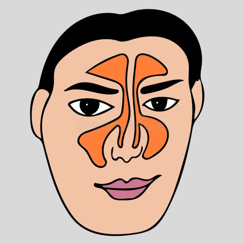 Sinusitis Infected Areas Face Illustration Stock Illustration ...