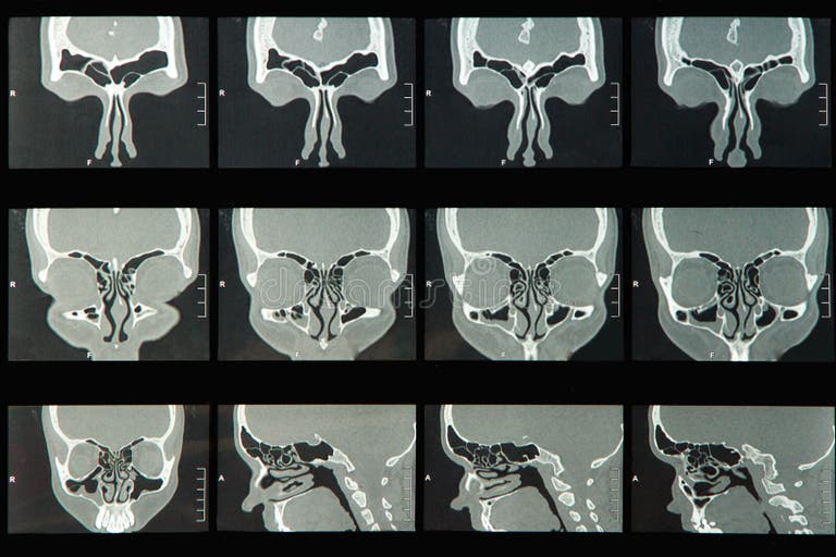 Nasal Endoscopy Egypt Stock Photos - Free & Royalty-Free Stock Photos ...