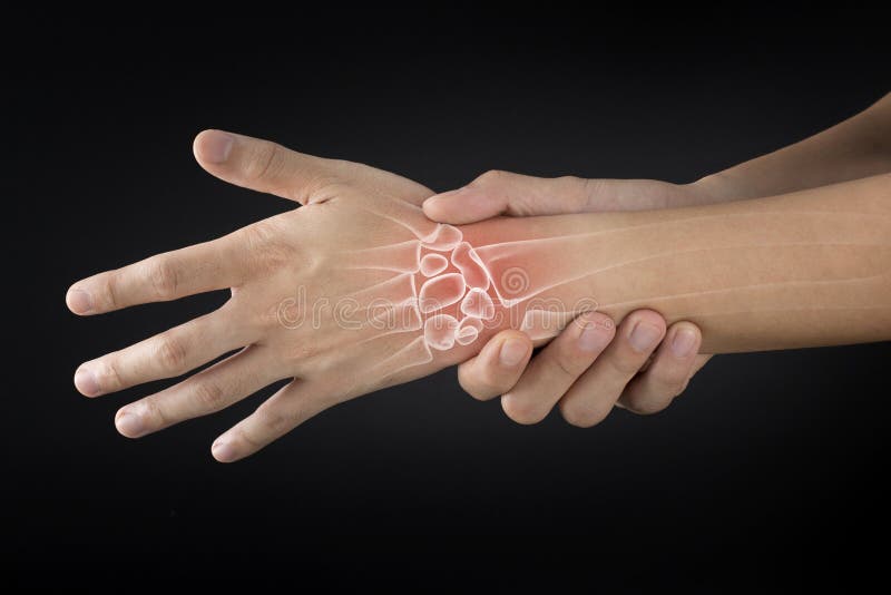 Skada f?r handledben arkivfoto. Bild av halvor, stuka - 145645468