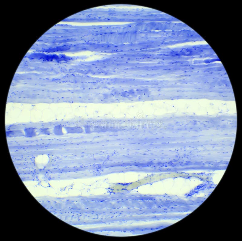 Skeletal Muscle Tissue Longitudinal Section Under a Microscope, Stock ...