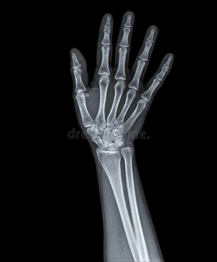 Skeleton of hand. stock photo. Image of body, showing - 94157148