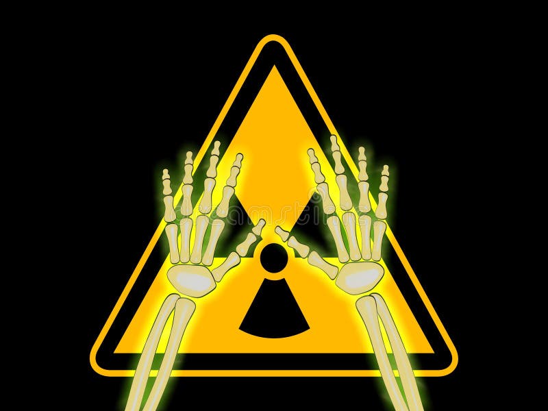 Skeleton Hands with Symbol of Radiation Warning Stock Illustration ...