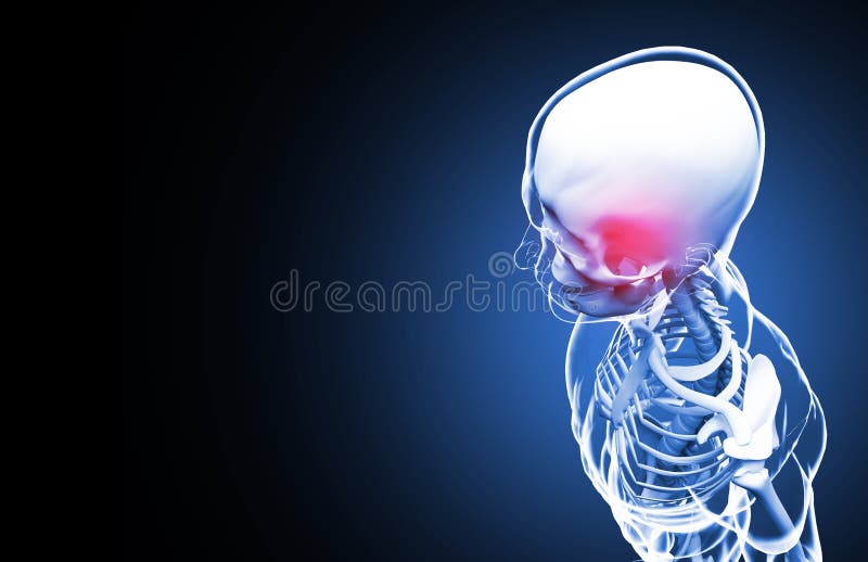 Headache Skeleton Stock Illustrations – 568 Headache Skeleton Stock ...