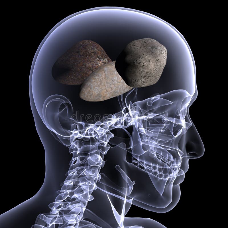 Thinking Skull Stock Illustrations – 1,223 Thinking Skull Stock ...