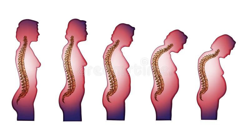 Skeleton_Spine Changing the Spine with Age Stock Illustration ...