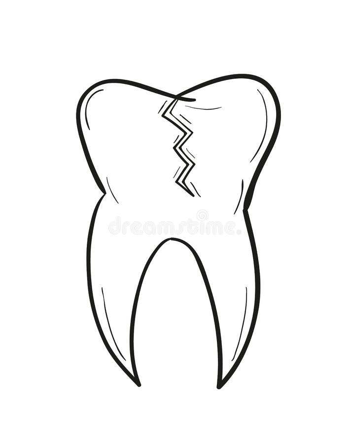 Sketch of the Tooth with Defect Stock Illustration - Illustration of ...