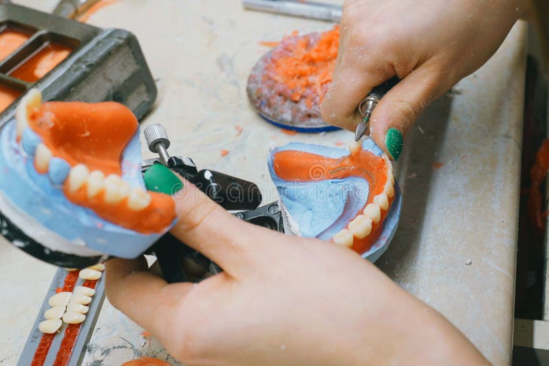 Crafting Precise Dentures through Careful Grinding and Shaping in a ...