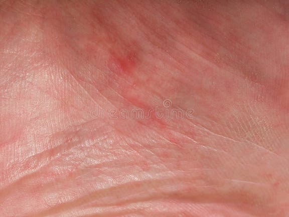 290 Human Flesh Texture Stock Photos - Free & Royalty-Free Stock Photos ...